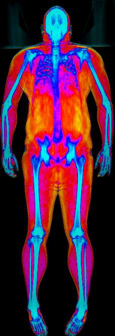 Example DEXA Body Composition Report | Body View