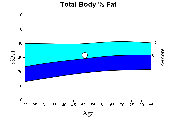 Example DEXA Body Composition Report | Body View